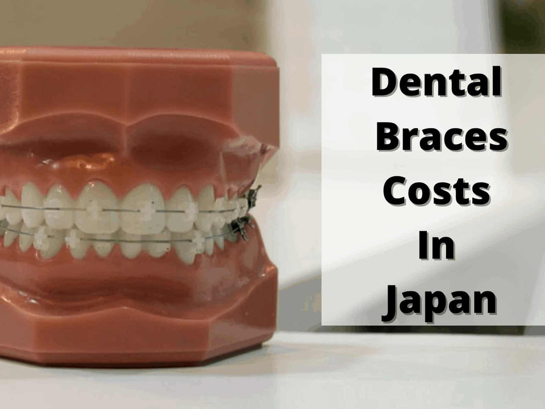 Learn – Tagged "teeth retainer in japan" – Japan Truly